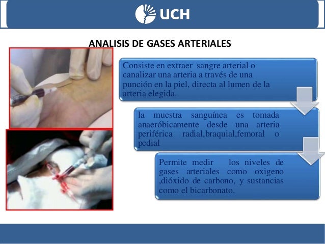 Gases Arteriales Arterial Blood Gas And Venous Blood Gas Values Of All
