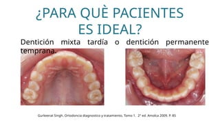 Análisis de discrepancia de Korkhaus o Pont | PPTX