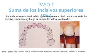 Análisis de discrepancia de Korkhaus o Pont | PPTX