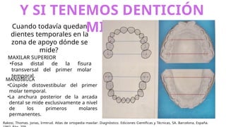 Análisis de discrepancia de Korkhaus o Pont | PPTX