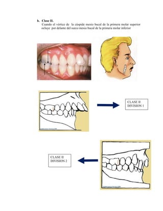 Analisis de modelos | DOCX
