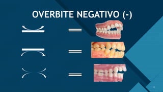 Analisis de modelos (2).pptx
