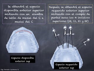 analisis de moyers analisis de modelos de estudio | PDF