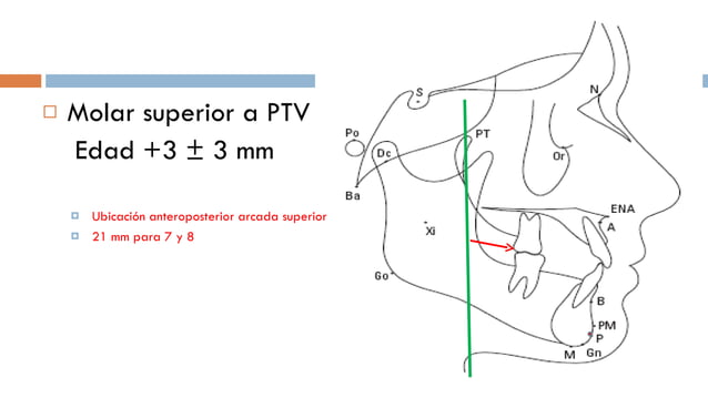 Analisis de Ricketts Resumido