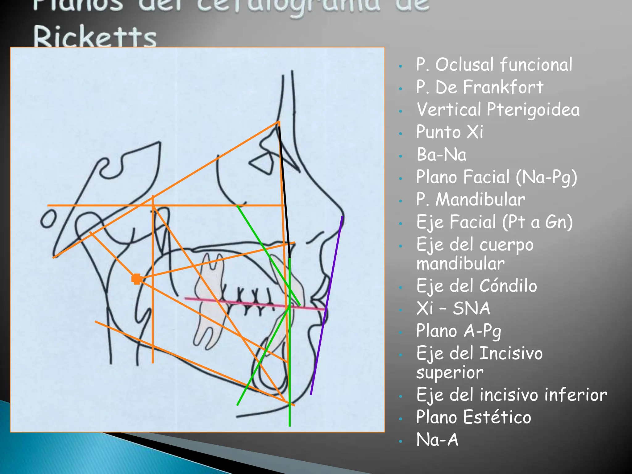 ANALISIS DE RICKETTS ORTO.ppt