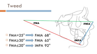 Analisis de tweed | PPT