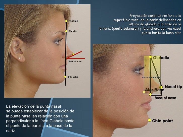 Analisis facial