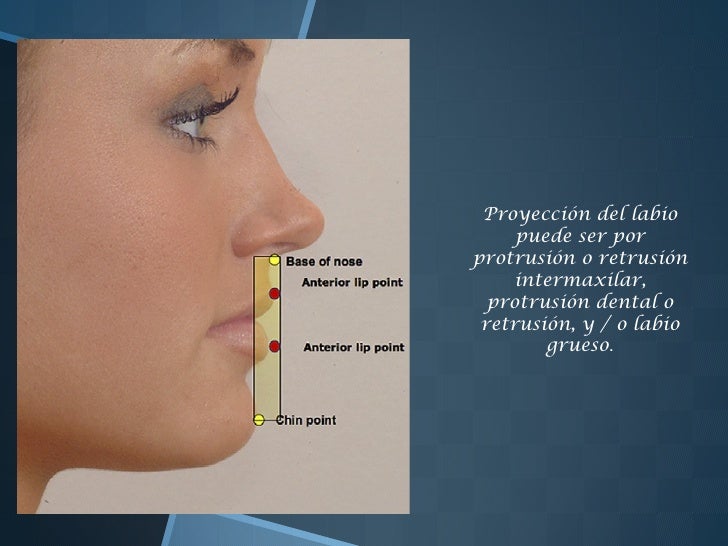 Analisis facial