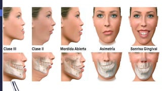 vitamina Lingüística acampar tipos de perfiles del rostro martes Nebu ...