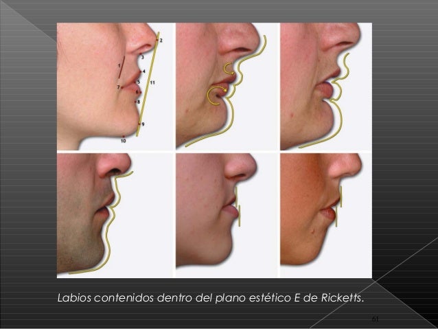 Analisis facial regional