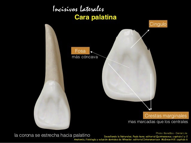 Análisis Intrabucal