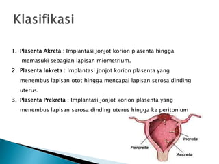 Analisis jurnal management of plasenta previa and accreta | PPTX
