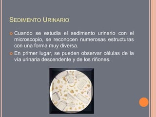 Analisis microscopico de orina | PPTX