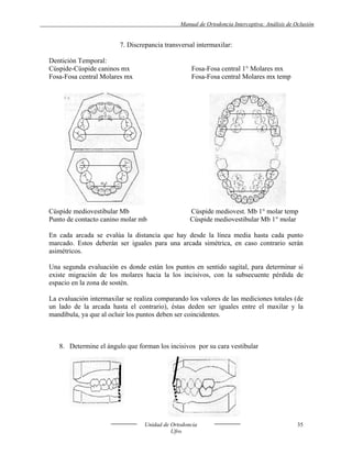 Analisis oclusión | PDF