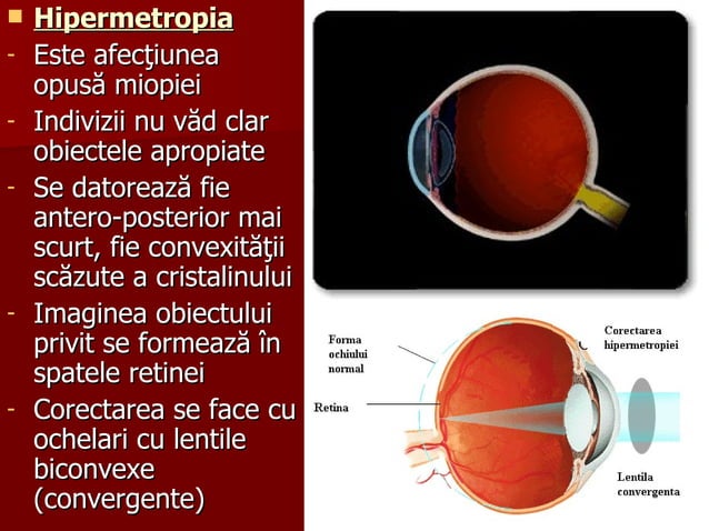 Analizatorul vizual | PPT