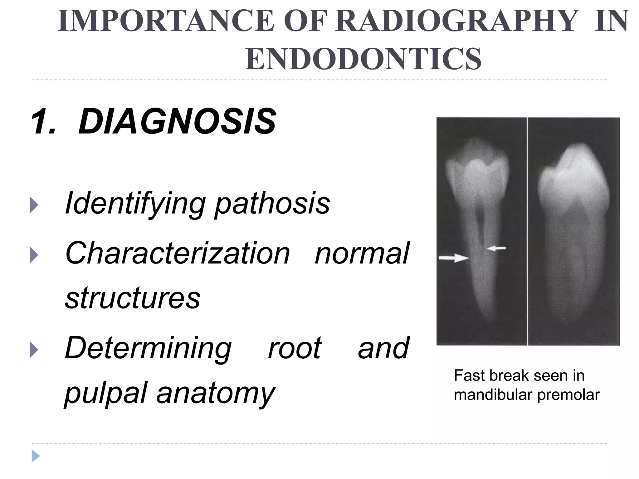 ANALOG RADIOGRAPHY SEM1.pptx