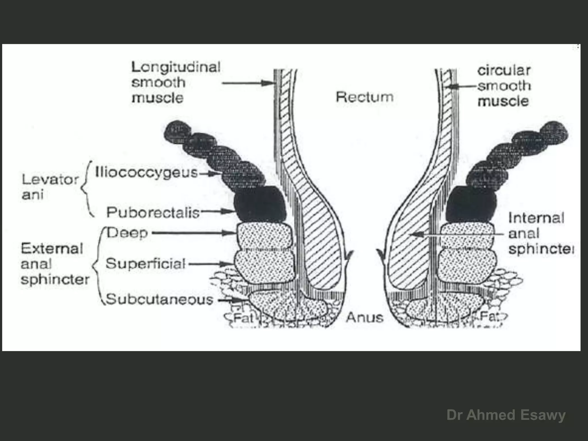 Anal perianal imaging part 1 CT MRI anatomy Dr Ahmed Esawy | PDF