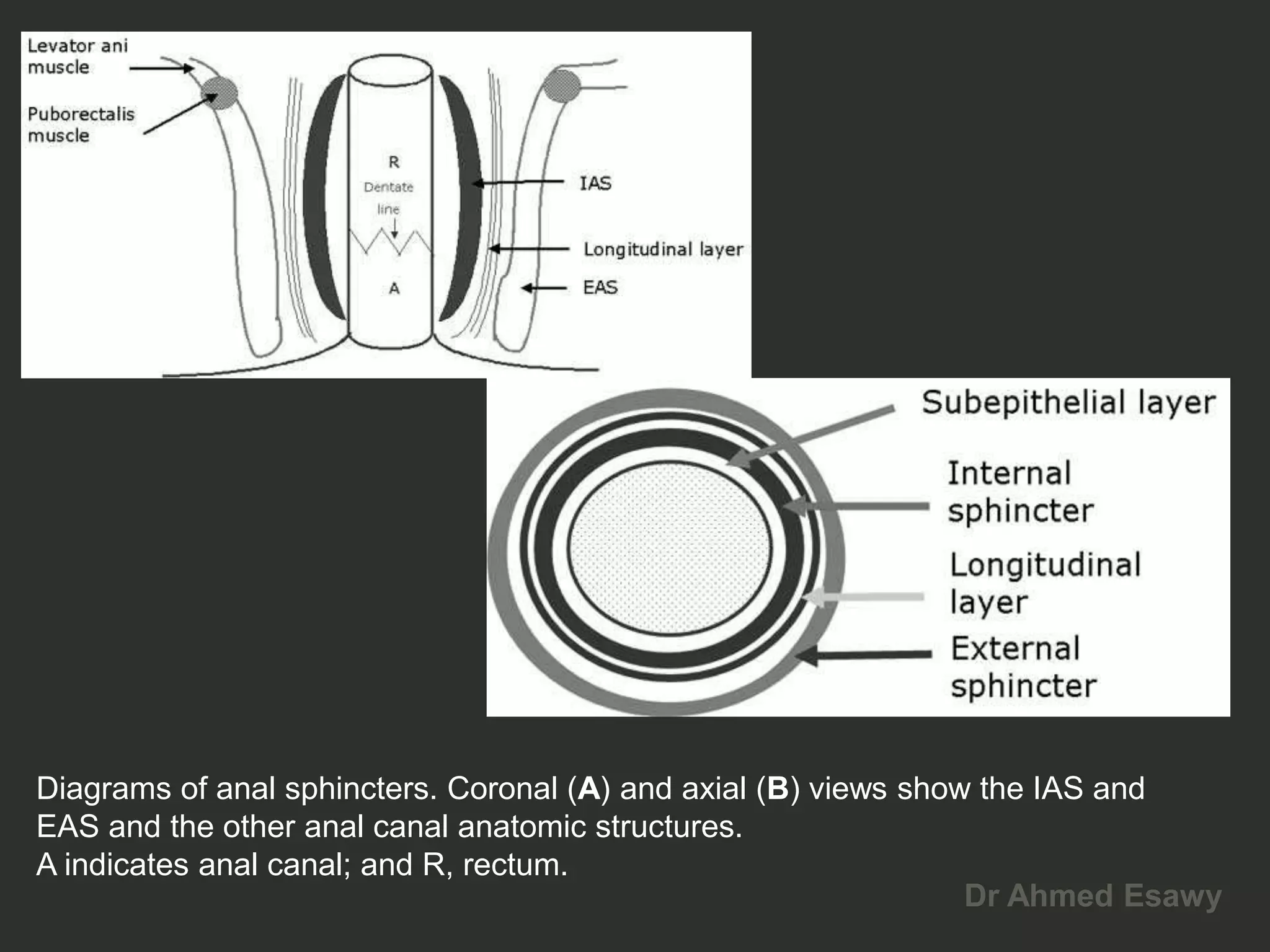Anal perianal imaging part 1 CT MRI anatomy Dr Ahmed Esawy | PDF