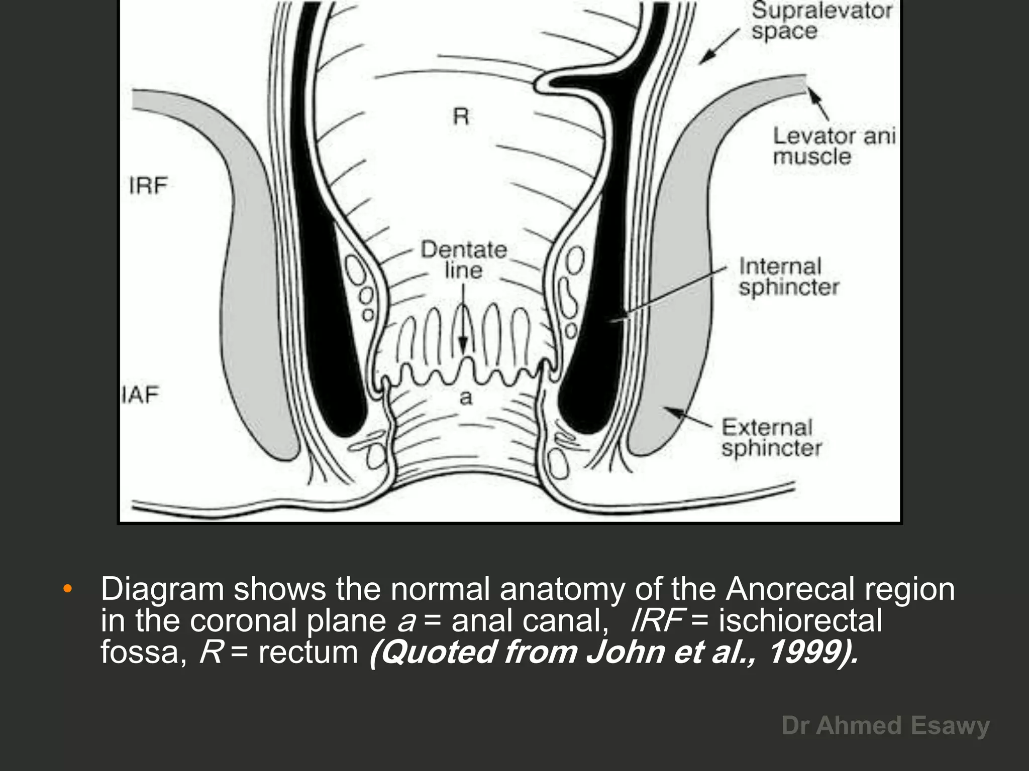 Anal perianal imaging part 1 CT MRI anatomy Dr Ahmed Esawy | PDF