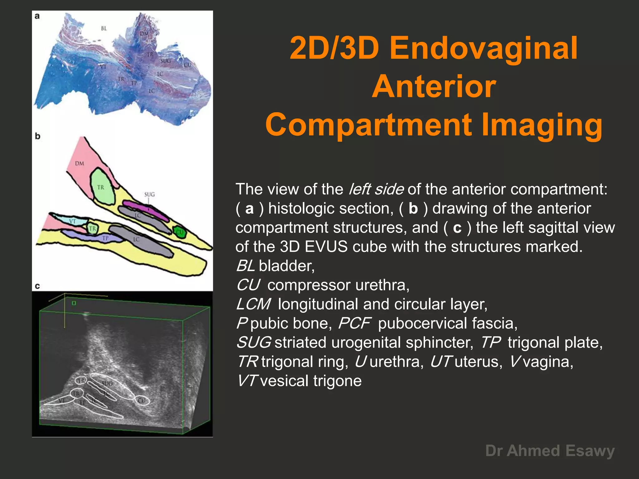 Anal perianal imaging part 1 CT MRI anatomy Dr Ahmed Esawy | PDF