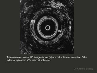 Anal perianal imaging part 1 CT MRI anatomy Dr Ahmed Esawy | PDF