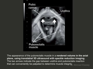 Anal perianal imaging part 1 CT MRI anatomy Dr Ahmed Esawy | PDF
