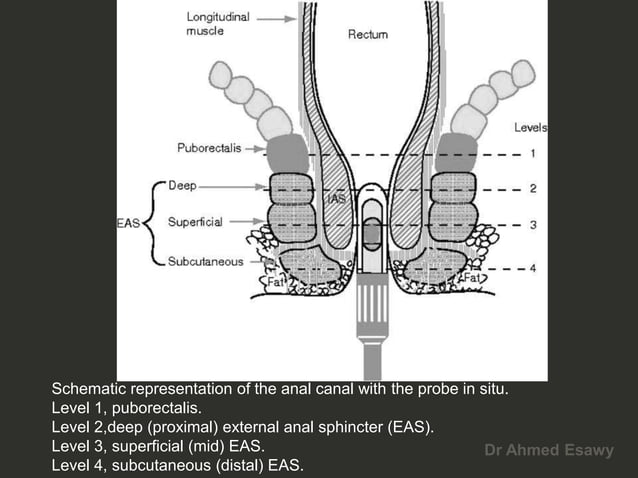 Anal perianal imaging part 1 CT MRI anatomy Dr Ahmed Esawy | PDF ...
