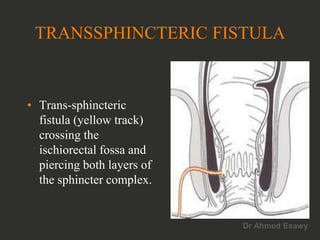 Anal perianal imaging part 2 perianal fistula CT MRI Dr Ahmed Esawy | PPT