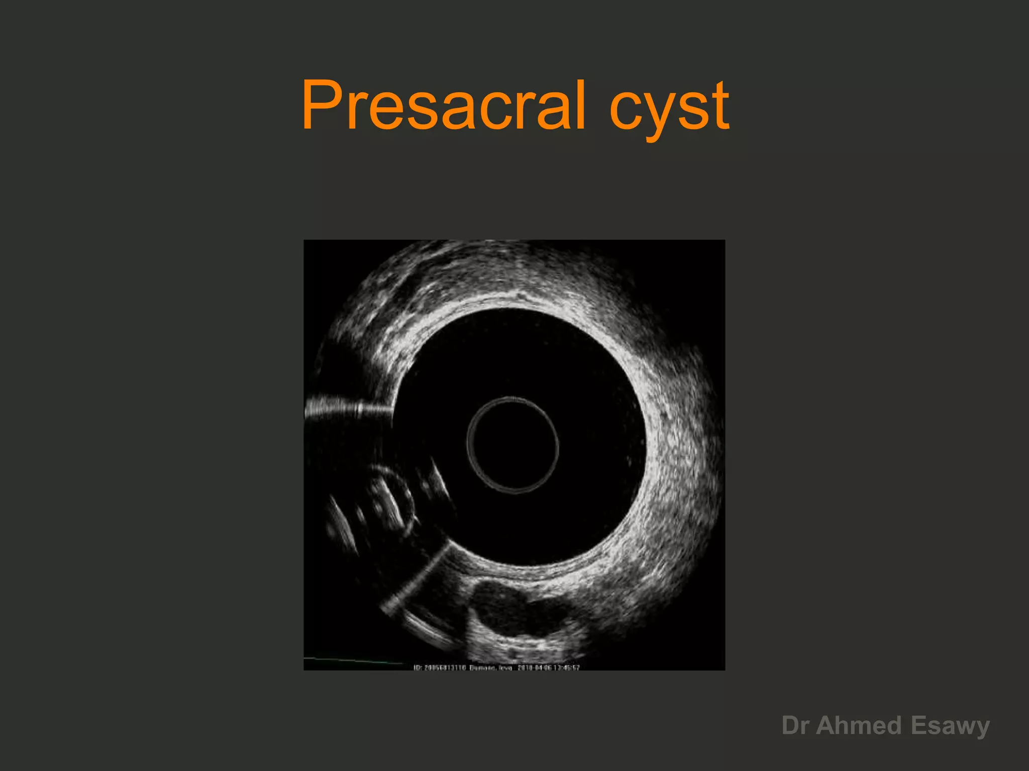 Anal perianal imaging part 4 in faecal continence CT MRI Dr Ahmed Esawy ...
