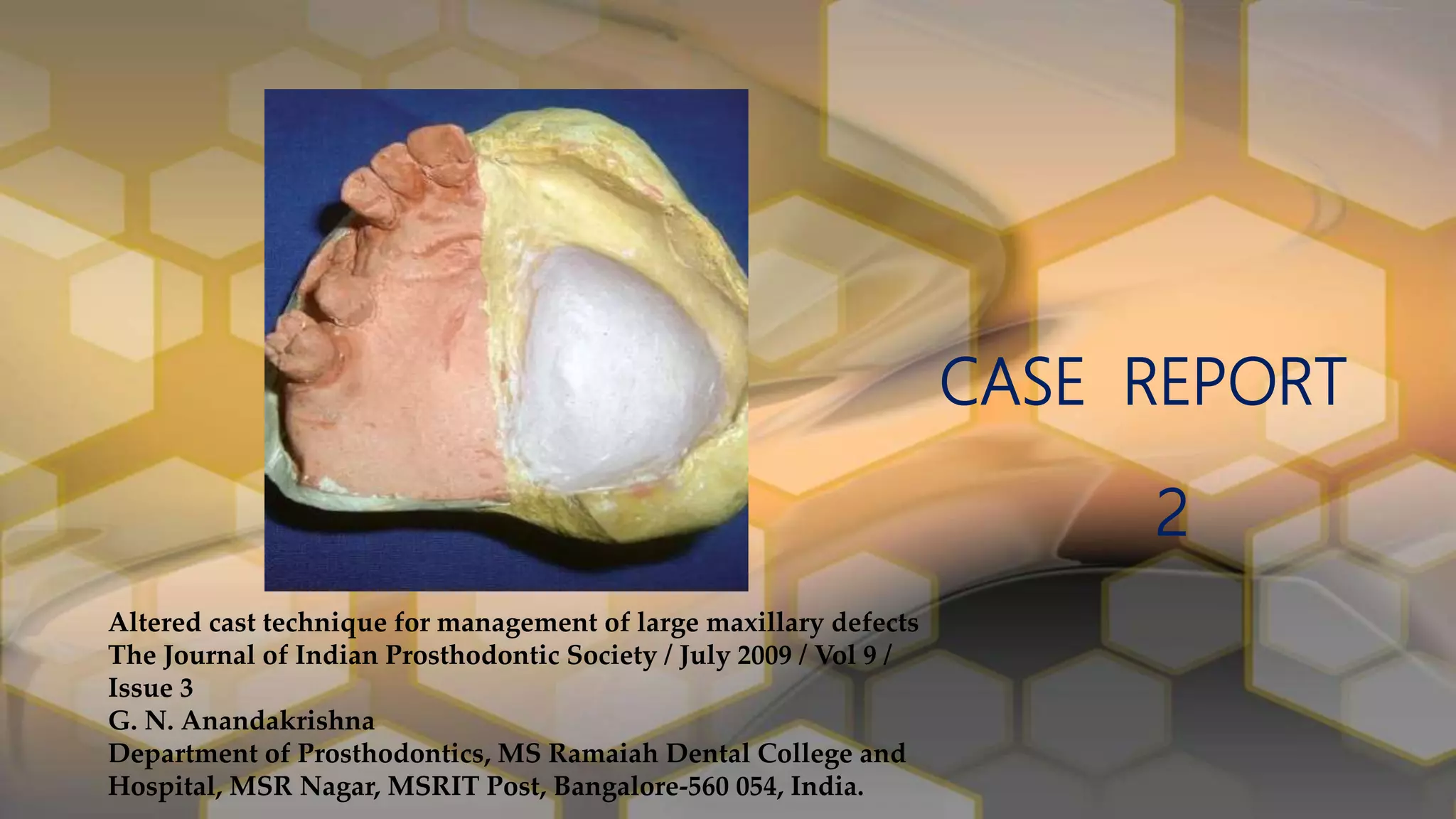 An altered cast procedure to improve tissue support | PPTX