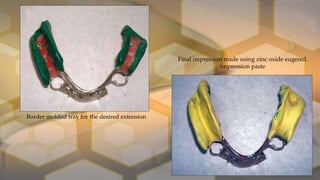 An altered cast procedure to improve tissue support | PPTX