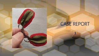 An altered cast procedure to improve tissue support | PPTX