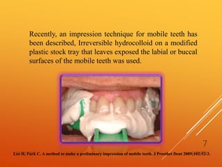 An alternative impression technique for mobile teeth | PPTX