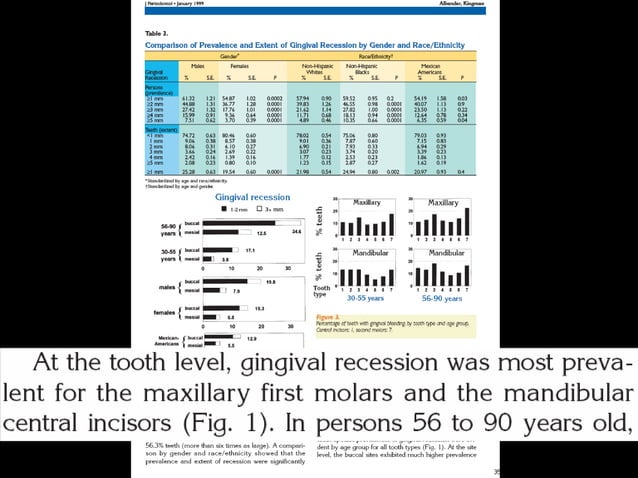 An Alternative To Autogenous Connective Tissue Grafting For Root