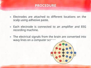 analyser,dental,ecg,eeg , semi, biomedical.pptx