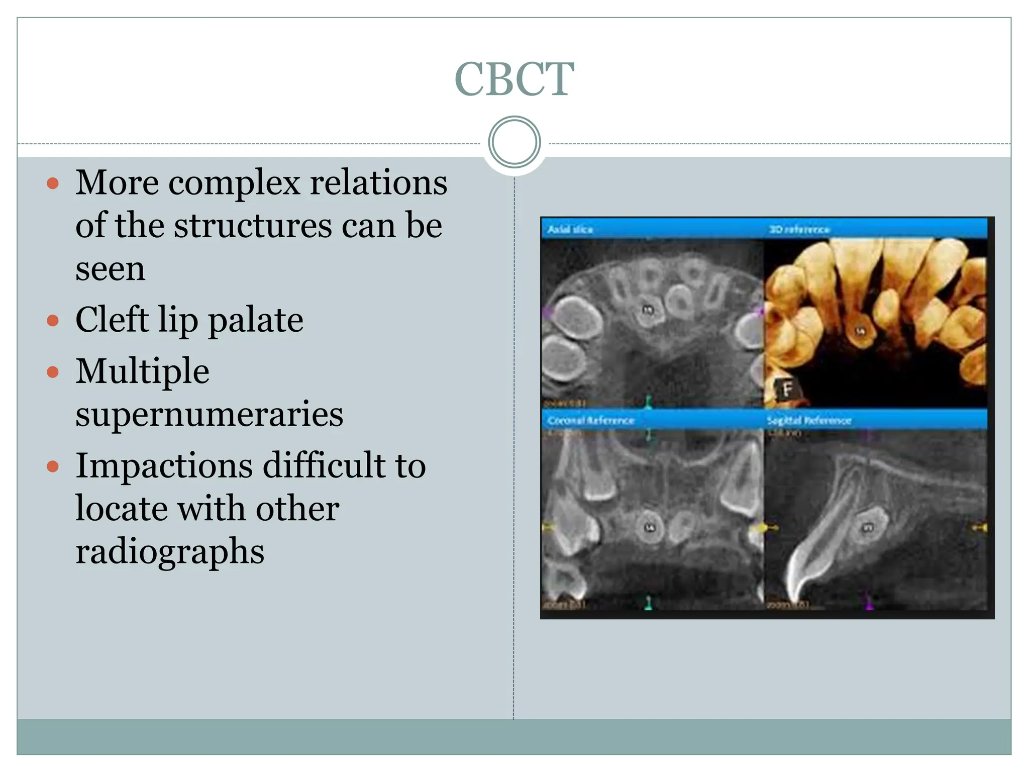 analysi of records.pptx a topic of orthodontics | PPTX