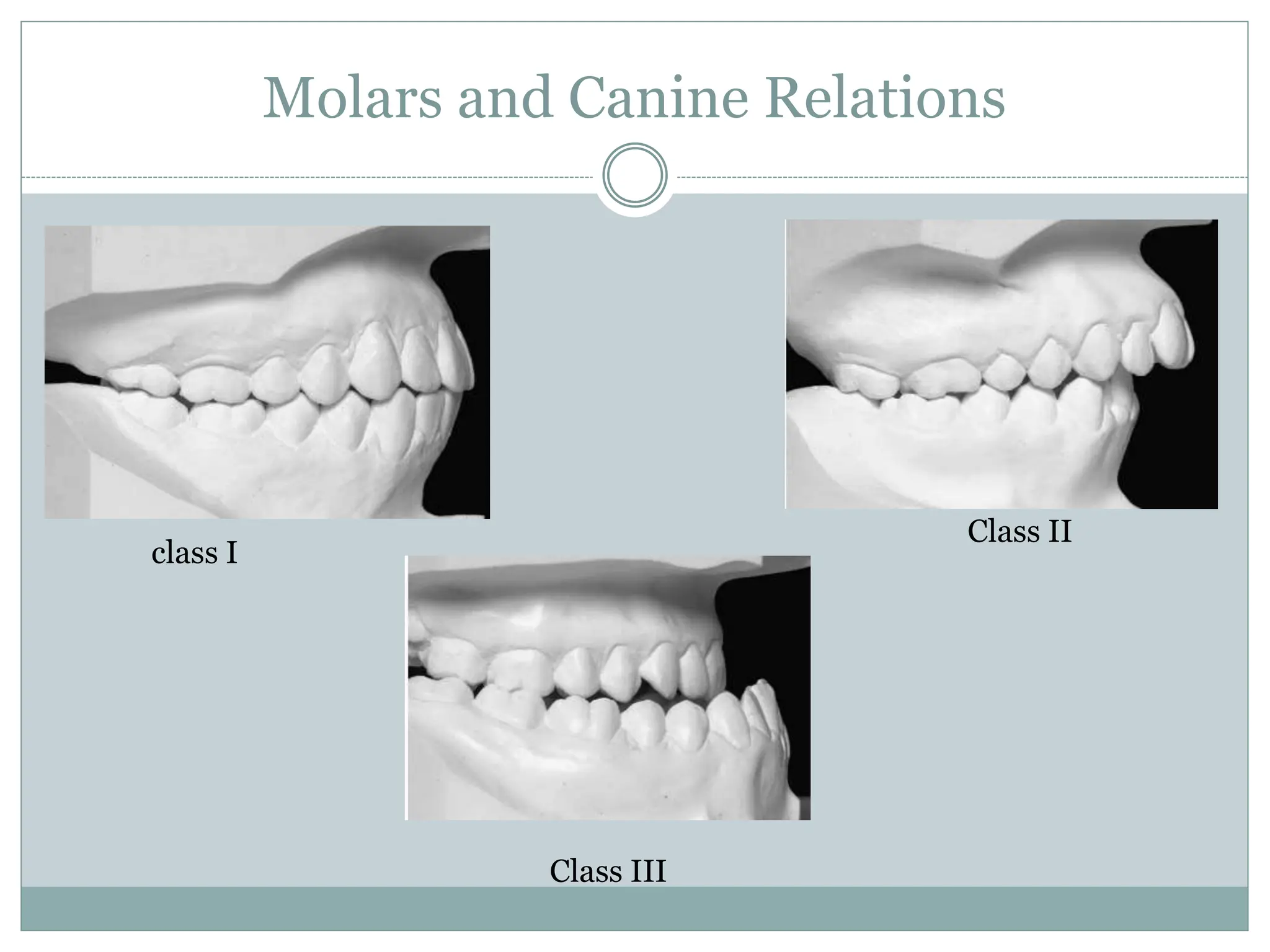 analysi of records.pptx a topic of orthodontics | PPTX