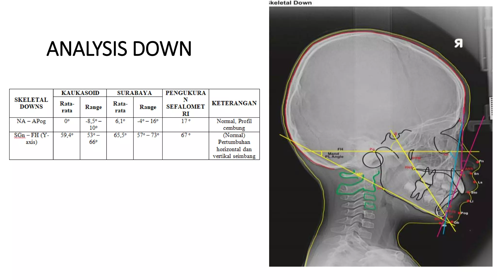 ANALYSIS DOWN dan ANALYSIS WITS.pptx