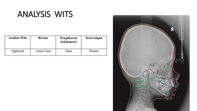 ANALYSIS DOWN dan ANALYSIS WITS.pptx