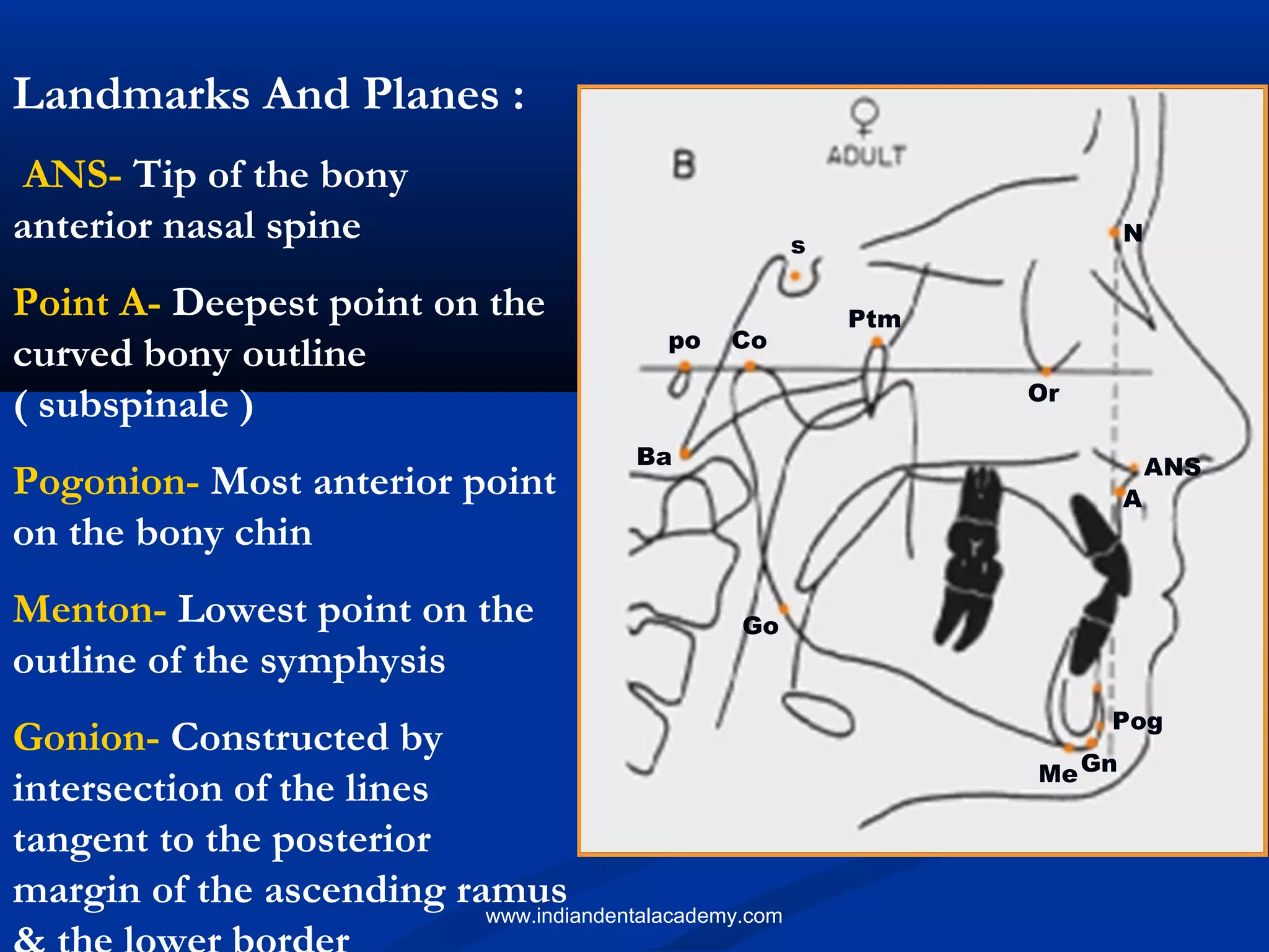 Analysis mc namara /certified fixed orthodontic courses by Indian ...