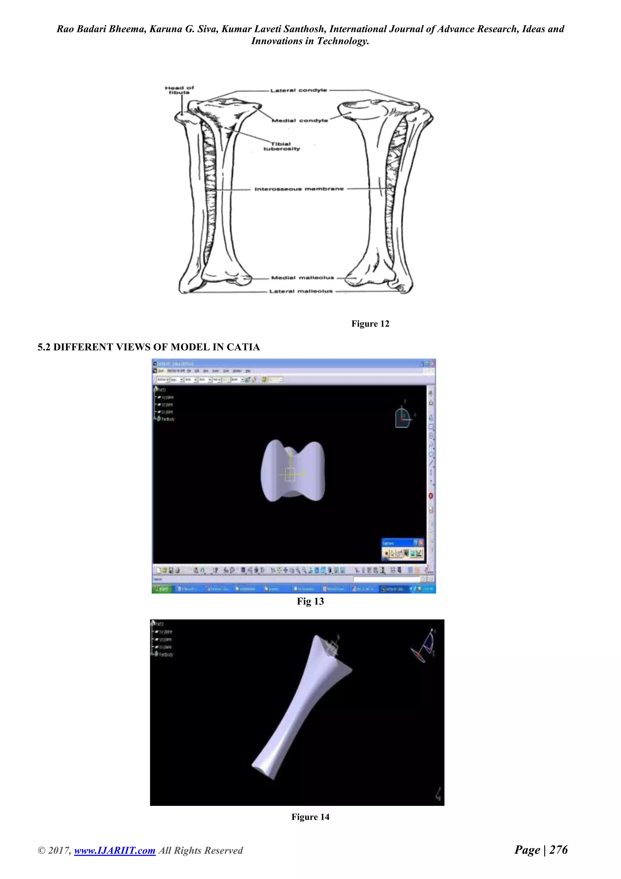 Analysis of knee joint in various postures and finite element analysis on tibia | PDF