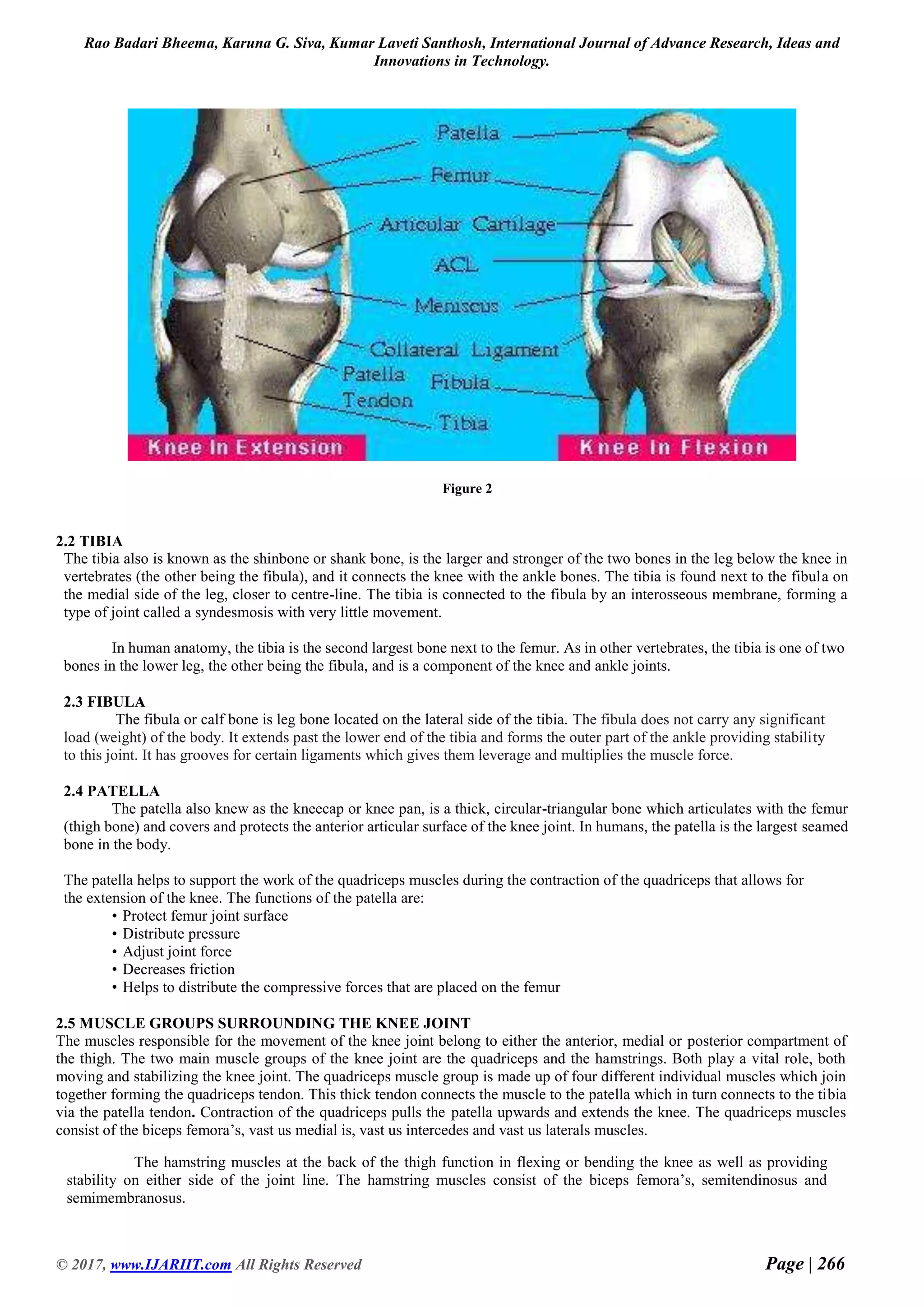 Analysis of knee joint in various postures and finite element analysis on tibia | PDF