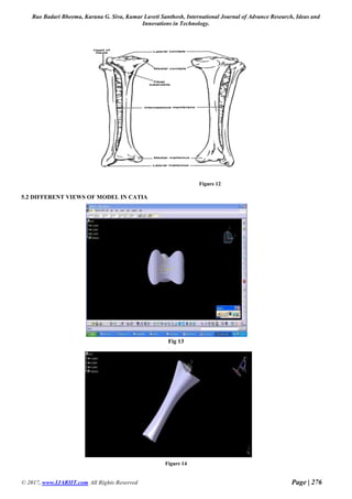 Analysis of knee joint in various postures and finite element analysis ...