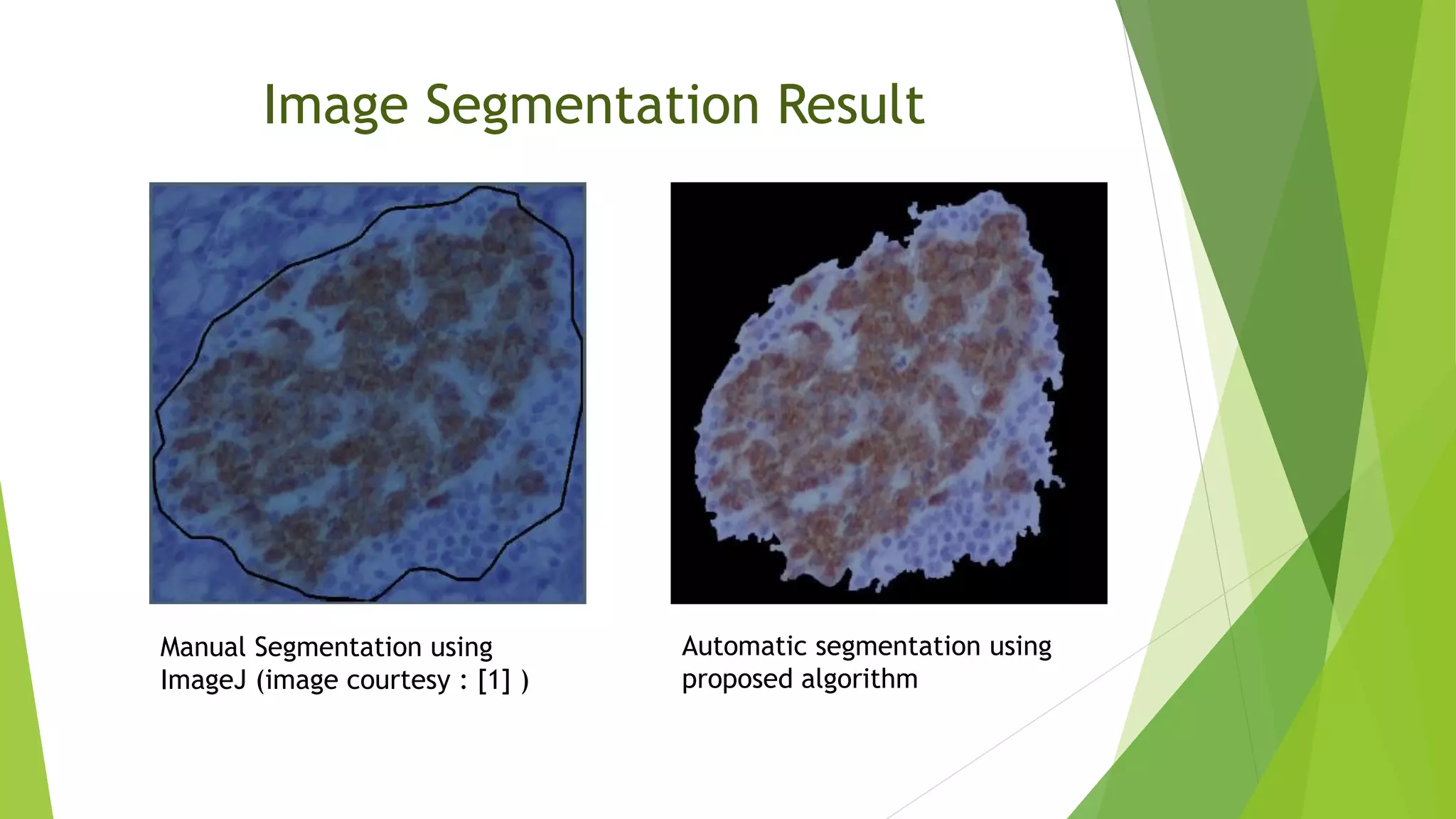 Analysis of pancreas histological images for glucose intollerance ...