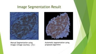 Analysis of pancreas histological images for glucose intollerance ...