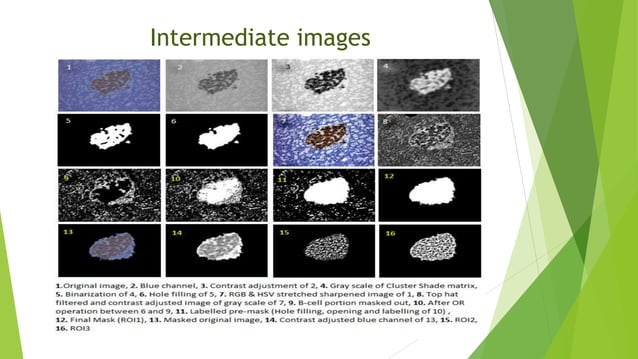 Analysis of pancreas histological images for glucose intollerance ...