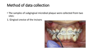 Analysis of plaque microflora pretreatment & during treatment of fixed ...