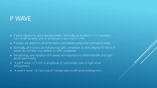 Analyze an Electrocardiogram | PPTX