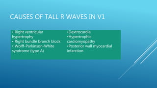 Analyze an Electrocardiogram | PPTX