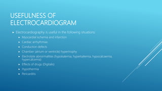 Analyze an Electrocardiogram | PPTX